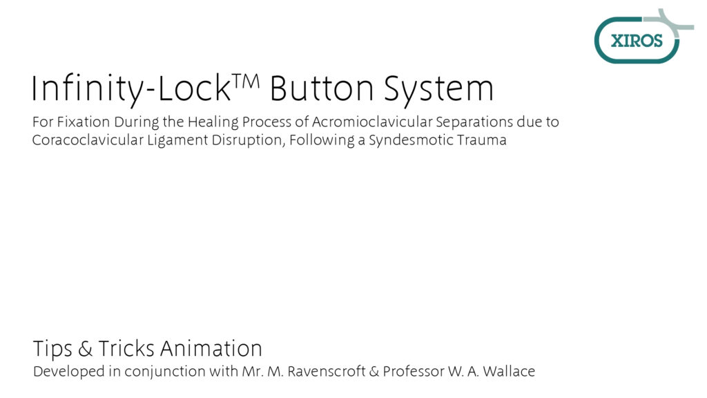 Infinity-Lock™ Button System - Xiros